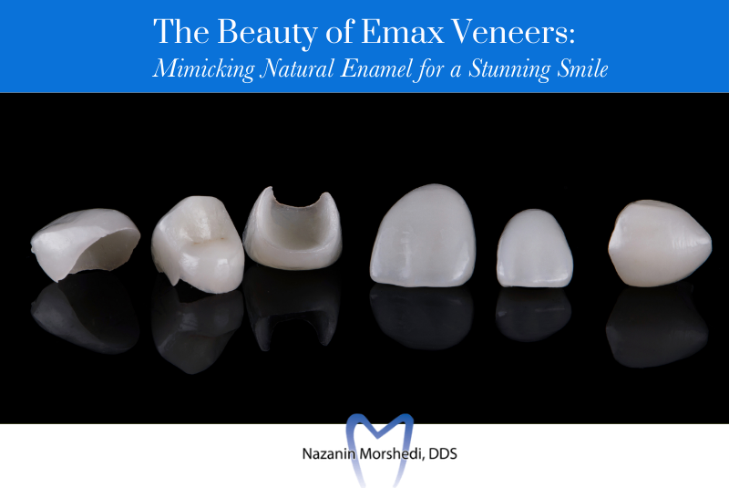 The Beauty of Emax Veneers: Mimicking Natural Enamel for a Stunning ...